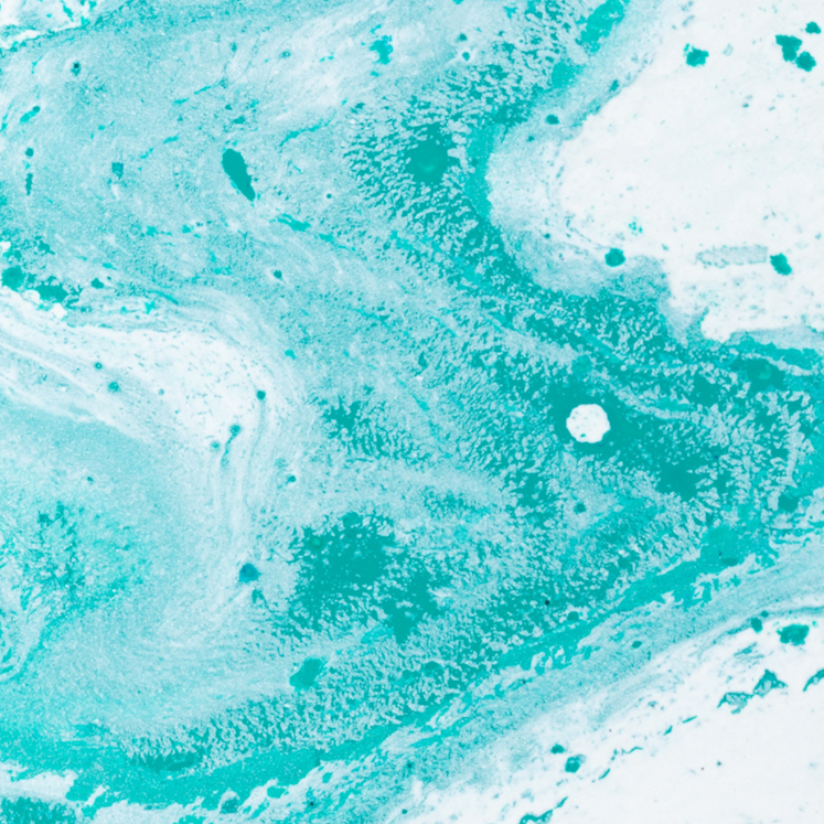 What is Schedule Adherence and Why is it Important in the Call Center?